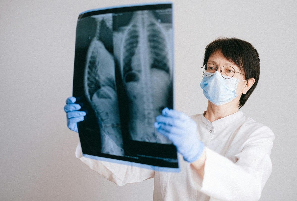 What Are the 4 Types of X-Rays? | NextGen Diagnostic Imaging Near ...